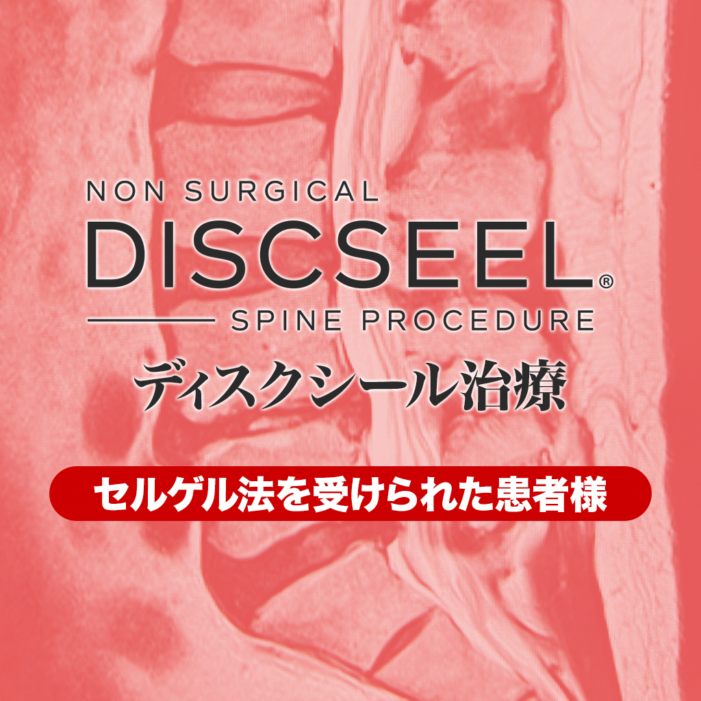 Discogel治療（別称：セルゲル法）で椎間板が修復すると説明された50代男性